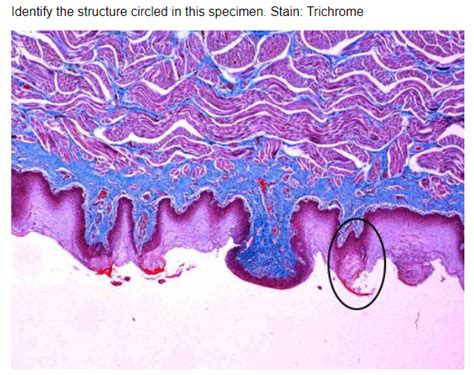 Solved Identify the structure circled in this specimen. | Chegg.com