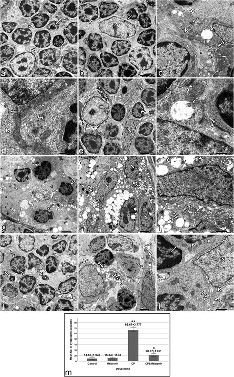 Electron Micrograph Of Thymic Cortex Ad Control Sections A The