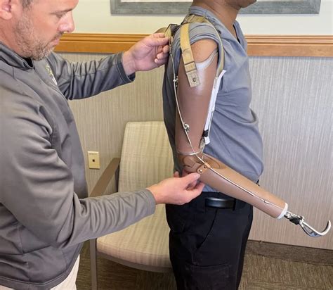 Upper Limb Prosthesis Peripheral Interfaces For Upper Limb Prosthetics