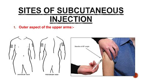 Ppt Administration Of Subcutaneous Injection Pptx Ppt