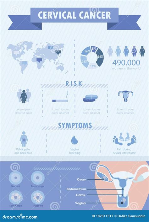 Cervical Cancer Infographic Design Stock Vector Illustration Of