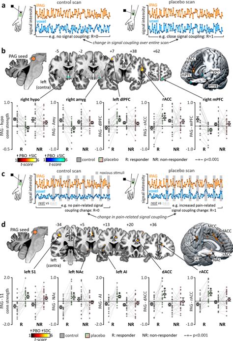 Stimulus Independent And Stimulus Dependent Cortico Brainstem