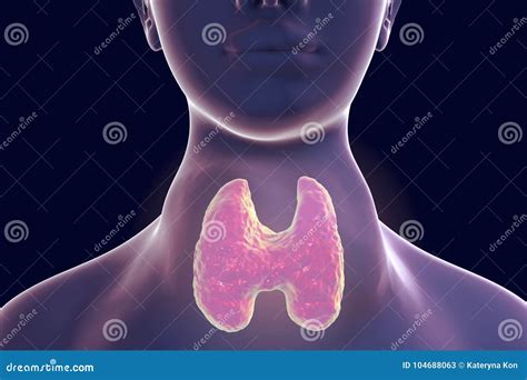 Toxic Diffuse Goiter Stock Illustration CartoonDealer Com 104687950