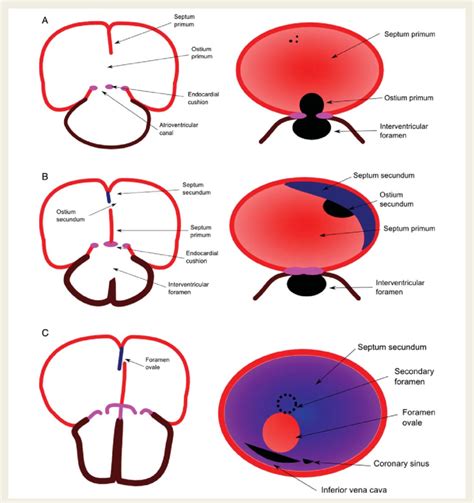 Diagram Of Atrial Septal Development A At Days B At Days Download Scientific