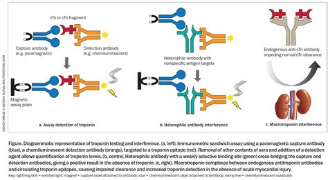 False Positive Cardiac Troponin In Clinical Practice Causes Assessment And Implications