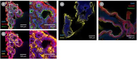 Stemdiff™ Branching Lung Organoid Kit Stemcell Technologies