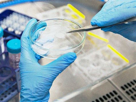 Lung Cancer Mutations Types Causes Treatment And More