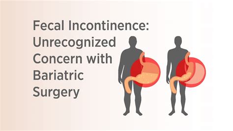 Fecal Incontinence Unrecognized Concern With Bariatric Surgery
