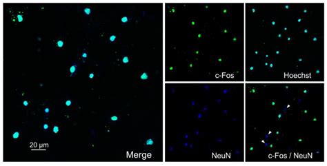 Lactoferrin Modulates Induction Of Transcription Factor C Fos In Neuronal Cultures