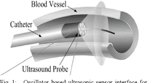 Figure 1 From A Novel Design Of Low Energy Oscillator Based Ultrasound Sensor Edge For