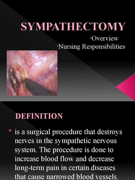 Sympathectomy Pdf Self Improvement