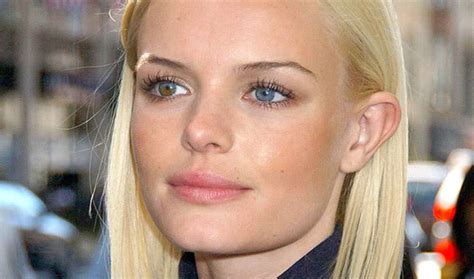 Kate Bosworth Heterochromia A Tale Of Mismatched Eyes