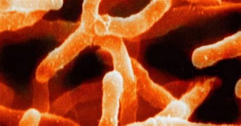 Actinomyces Israelii Image