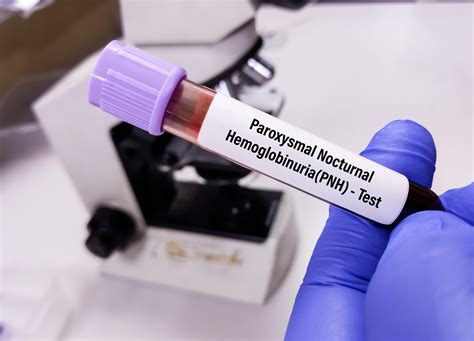 Paroxysmal Nocturnal Hemoglobinuria Rare Disease Advisor