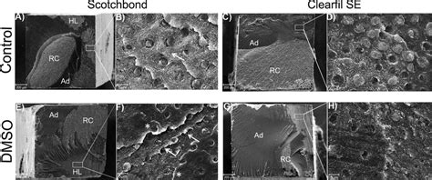 Representative Scanning Electron Micrographs Sem Of The Dentin Side
