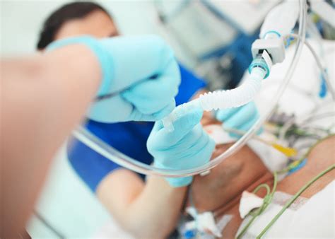 Difficult Intubation Indications Intubation Process And More