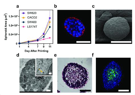 Features Of Bioprinted Tumour Spheroids A Growth Of All Four Cancer