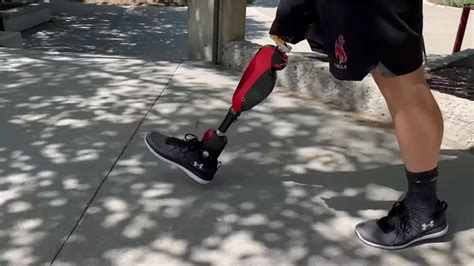 Advanced Bionic Leg
