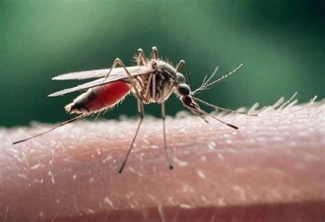 14 Effective Home Remedies For Treating Mosquito Bites