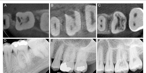 Figure 1 From Impact Of Cone‐beam Computed Tomography On Treatment Planning For External