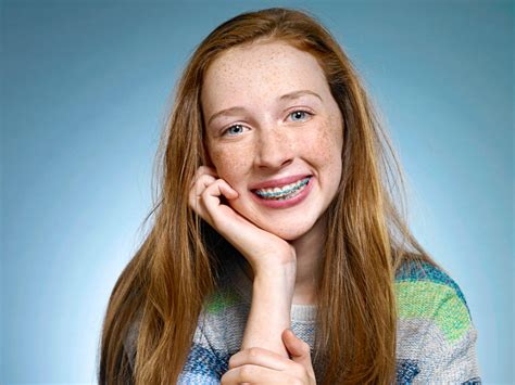 Braces In Middletown By Ocorthous On Deviantart Braces In Middletown By Ocorthous On Deviantart