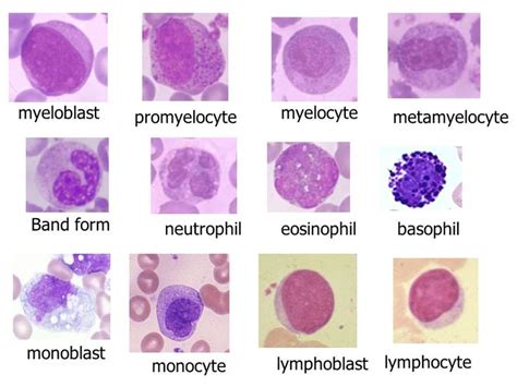 Pin By Yam Moors On Pathology Hematology Medical Technology Medical