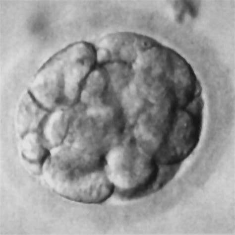 Pdf Morphological Evaluation Of Human Embryos And Derivation Of An