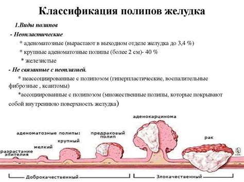 Полипы в матке: причины образования, симптомы, факторы риска, лечение и ...
