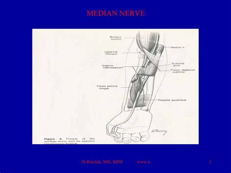 Electromyography And Upper Extremity Disorders Ppt