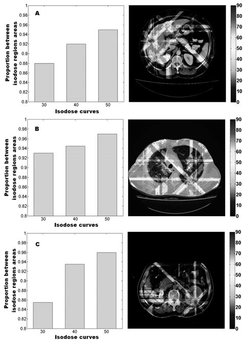 Proportion Between Isodose Regions Areas Respectively For The Images