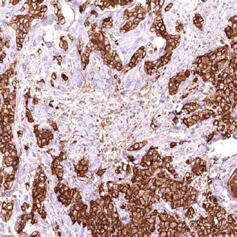 Muc 1供应商 生产厂家 厦门通灵生物医药科技股份有限公司