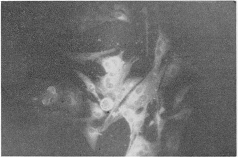 Visna Infected Sheep Choroid Plexus Cell Monolayer Treated With Immune