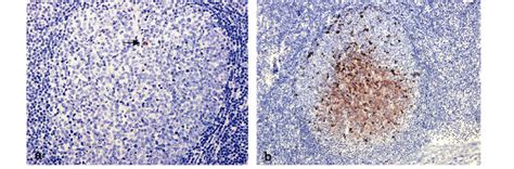 Accumulation Of Prp D In Lymphoreticular Tissues Retropharyngeal Lymph