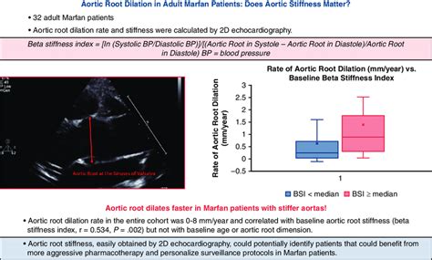 Aortic Root Dilates Faster In Patients With Marfan Syndrome With