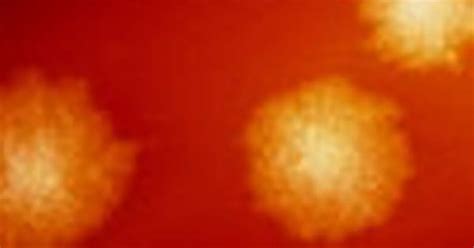 Deadly C Diff Outbreak Victim Predicted Her Own Death As She Said