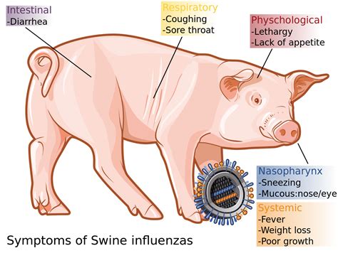 Swine Flu Or H1n1 Flu Virus Symptoms And Prevention