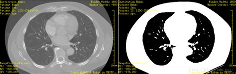 opencv 区域生长算法 opencv中的区域生长算法 csdn博客