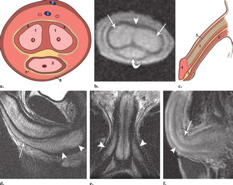 Schematic Penis Anatomy Download Scientific Diagram
