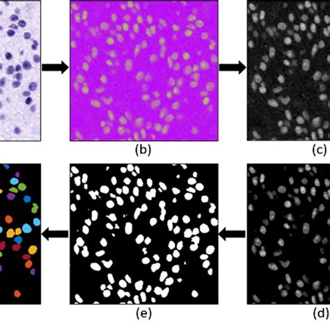 The Complete Process For Nuclear Segmentation Of Cancer Cells A