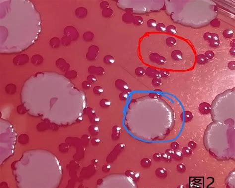 【干货】霉菌和酵母检测怎么鉴定？ 知识概念 实验与分析