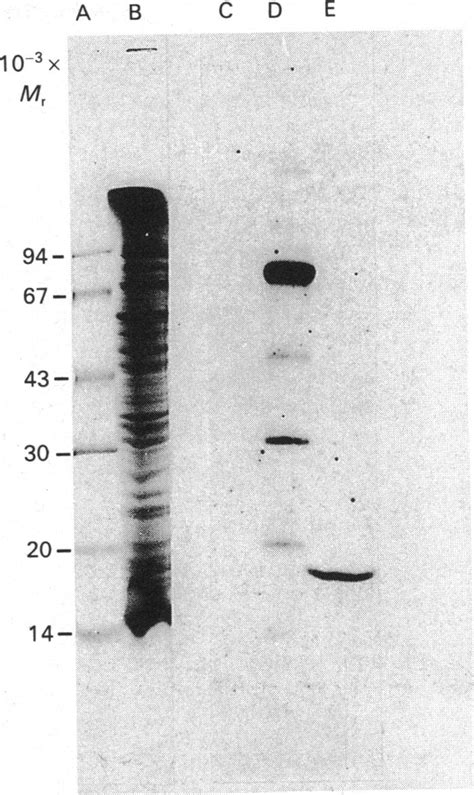 Immunoblotting Of A Mastocytoma Microsomal Fraction A Crude Microsomal