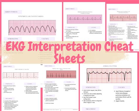 Ecg Interpretation Cheat Sheet What Exactly Is An Ecg An 51 Off