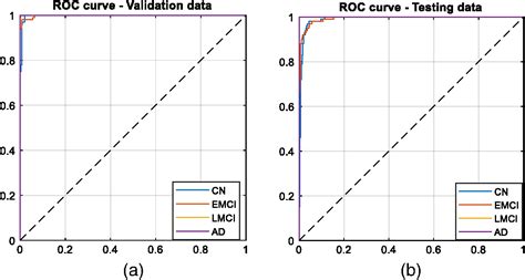 Spatiotemporal Feature Extraction And Classification Of Alzheimers Disease Using Deep Learning
