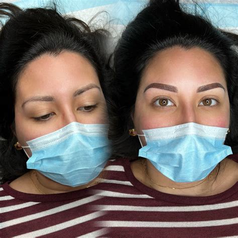 Brow Correction Photos The Brow Clinique