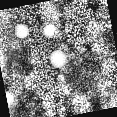 Waterborne Pathogens Detection Object Detection Dataset And Pre Trained