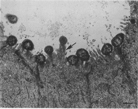 Transmission Electron Micrograph Of Cecal Crypt Epithelium From A
