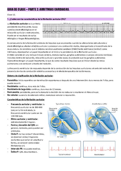Guia De Clase 12 Segunda Parte Arritmias Cardiacas Guia De Clase