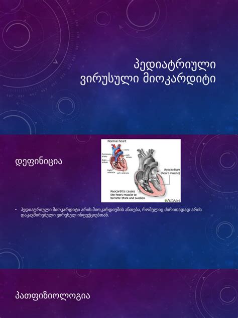 Pediatric Myocarditis Pdf