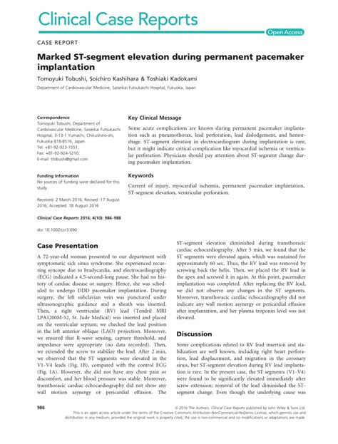 Pdf Marked St Segment Elevation During Permanent Pacemaker Implantation