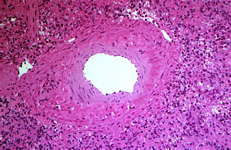 Trabeculae Histology Spleen